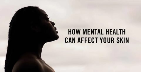 Psychodermatology: The Skin-Mind Connection | Aestha Clinic