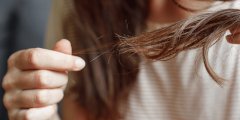 Hormonal Hair Loss in Women | Aestha Clinic