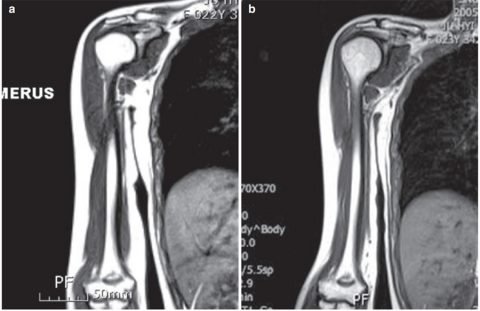 Barbie Botox Goes Viral! What You Need To Know!