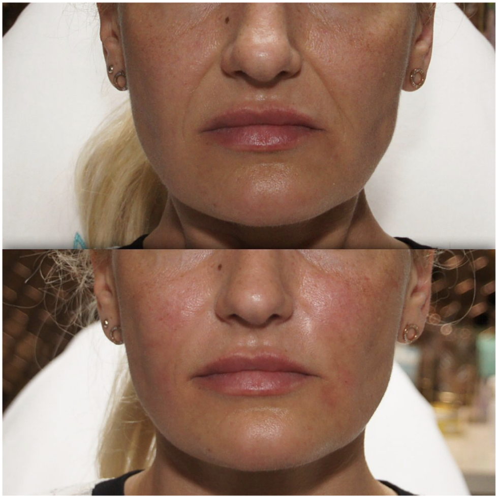 Lenisna | Unique Tissue Stimulator | Patented Formula