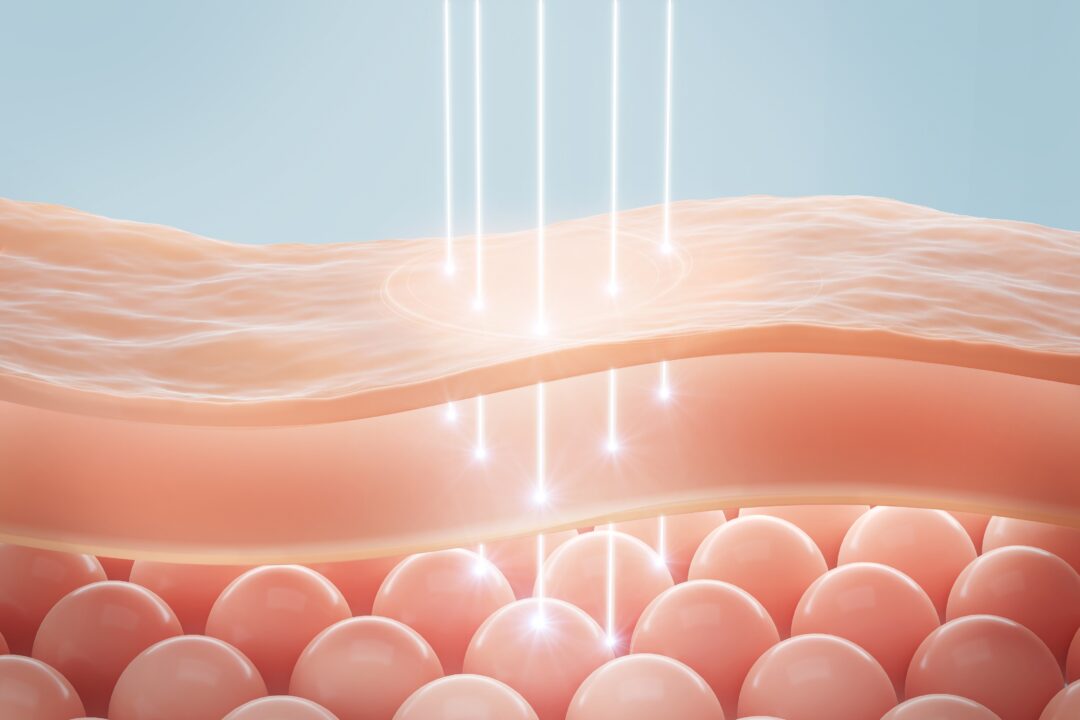 Collagen Biostimulation Treatments: Regenerative Aesthetics with ...